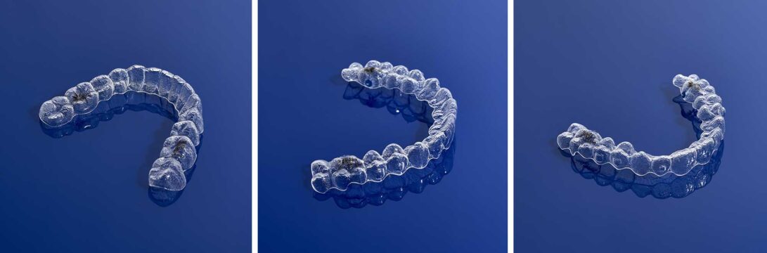 How Effective Are Invisalign Aligners®? | Smile Doctors