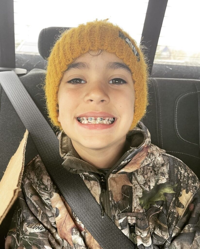 Invisalign® At-Home | Clear Aligners | Smile Express®