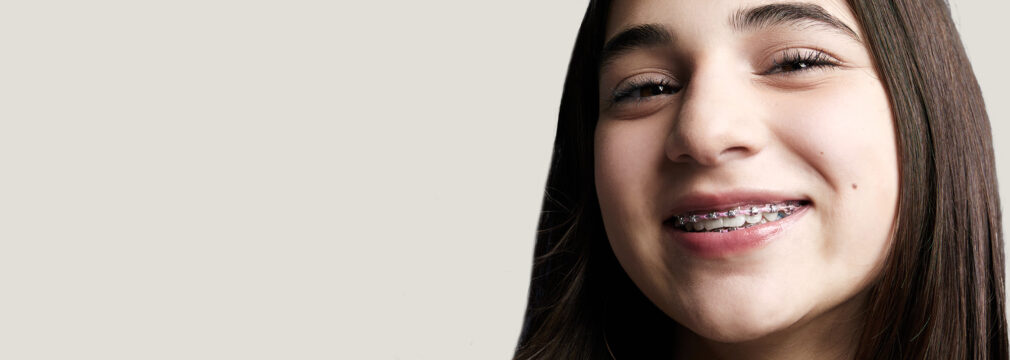 Braces for Adults, Kids, and Teens | Metal and Clear Braces
